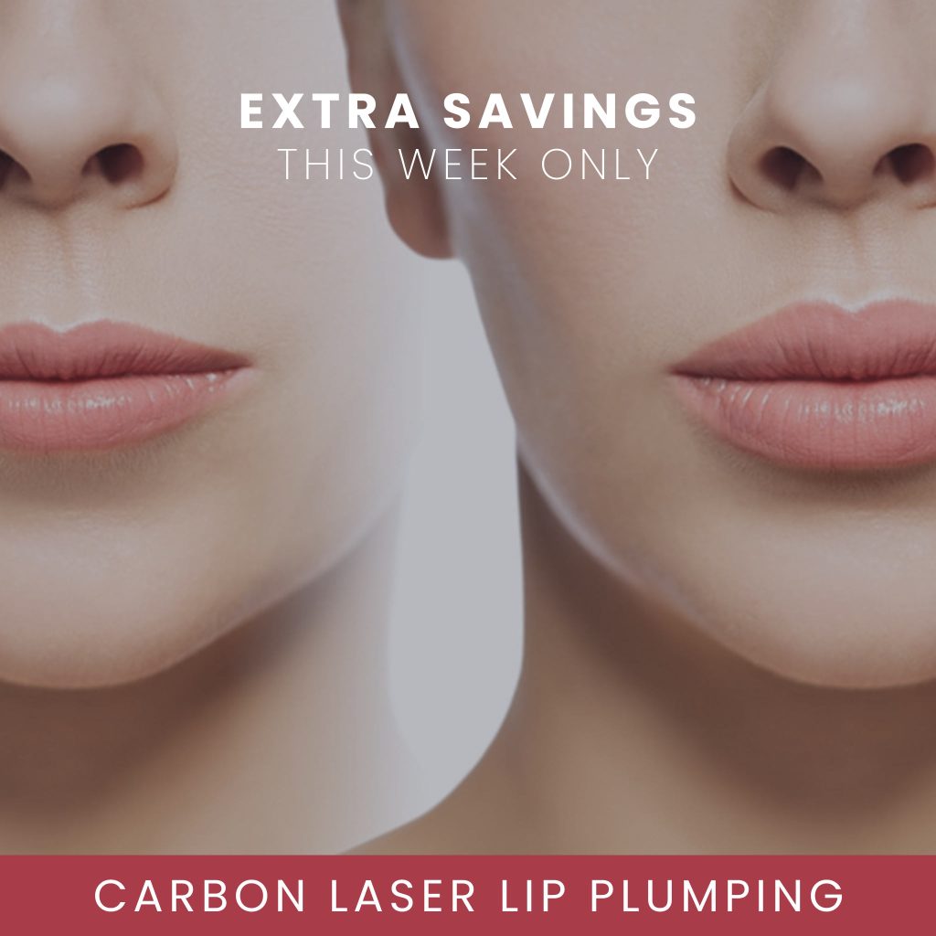 Online Carbon Laser Lip Plumping Course - The Online Beauty Courses ...