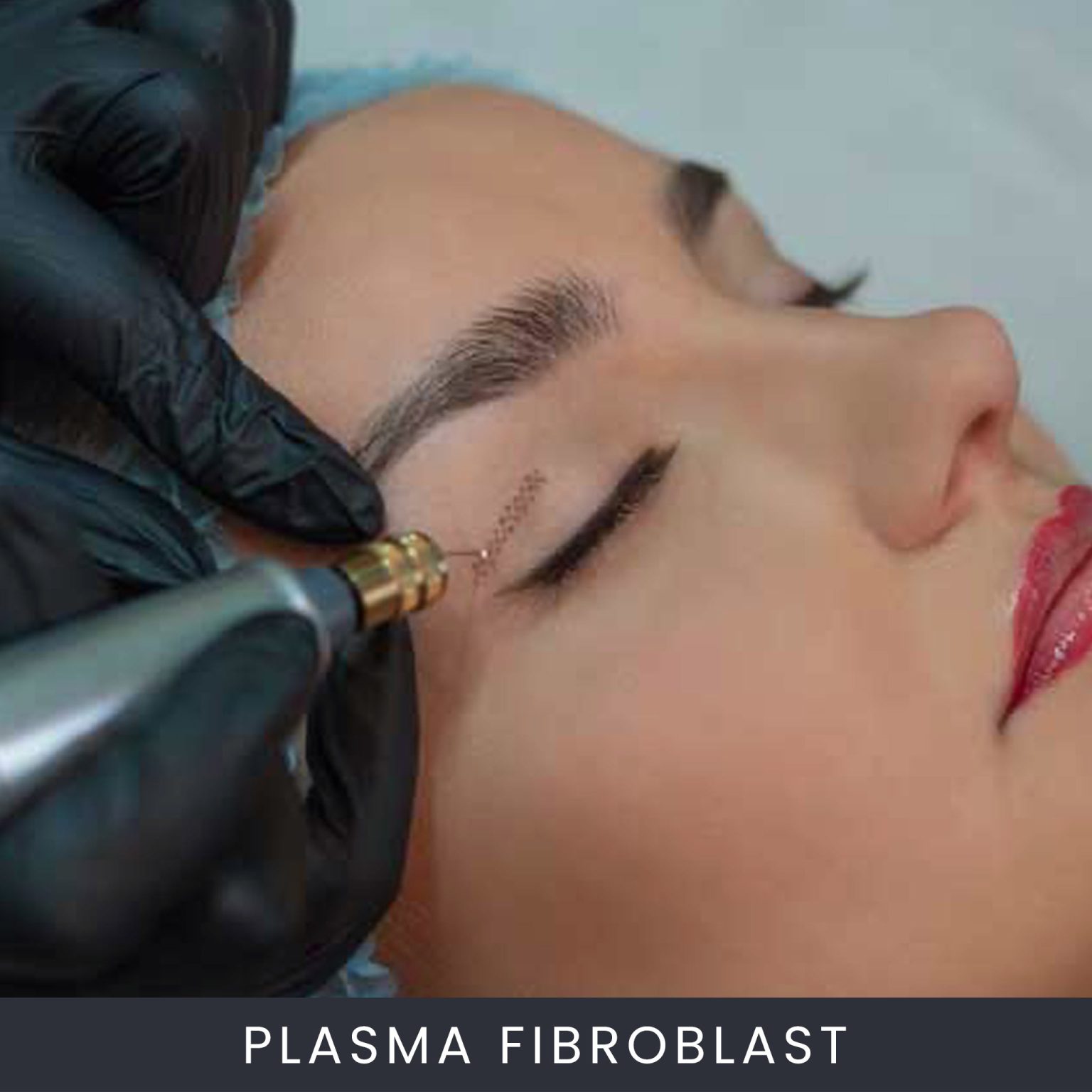 Online Plasma Fibroblast Skin Tightening Course - The Online Beauty ...